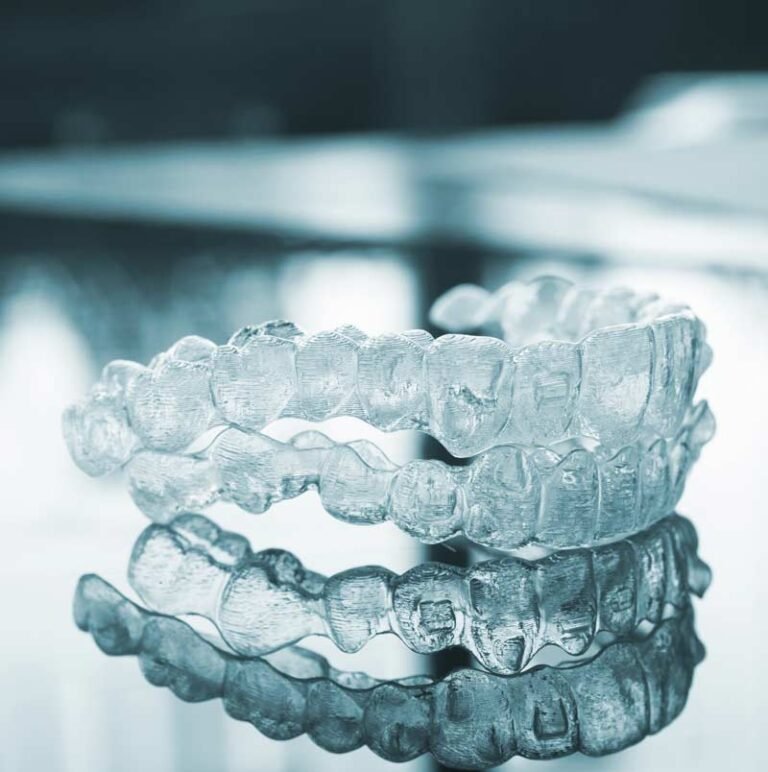 Invisalign Costs - Orthodontist Ottawa ON | Centrepointe Orthodontics